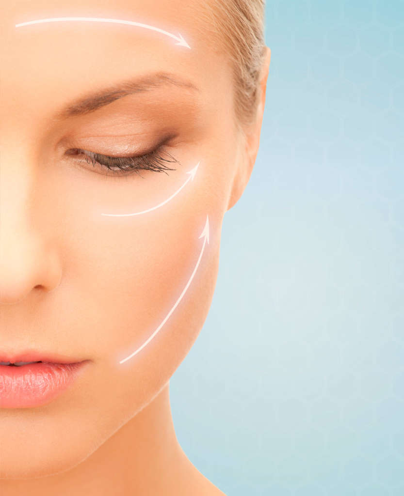 Minilifting Facial - Dr. Armando Iñiguez